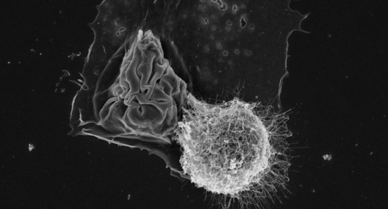 World Aids Day: Crowdfunder launched for lifesaving research into ...