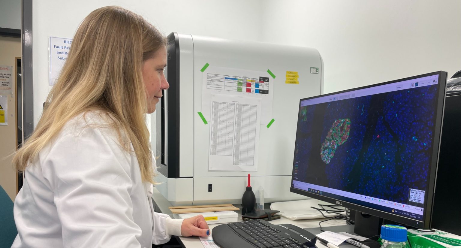 Exeter researcher awarded £1.5 million for research into root cause of ...