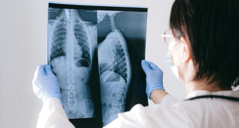 Increased use of chest x-rays linked to earlier lung cancer diagnosis ...